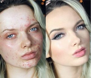 Dramatic Makeup Transformations: 31 Before and After Looks – SheIdeas